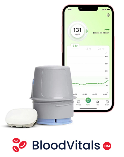 2025's Best Glucose Monitors Reviewed: The Leader Offers Painless 24/7 ...